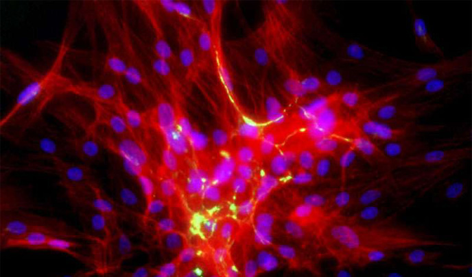 ‘Bad guy’ fibrocytes could help rebuild damaged tissue - School of ...