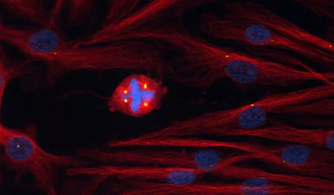 Researchers probe cell division defects to gain insight into cancer ...