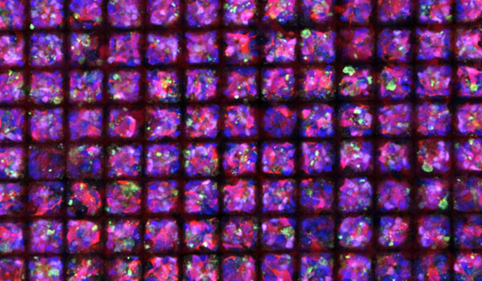 Uw Vision Researchers Partner With Us Department Of Defense To Develop Stem Cell Therapy For
