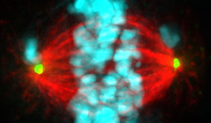 UW study details how HPV may promote head and neck cancer - School of ...