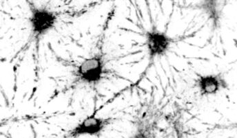 Stem Cells Archives - School of Medicine and Public Health